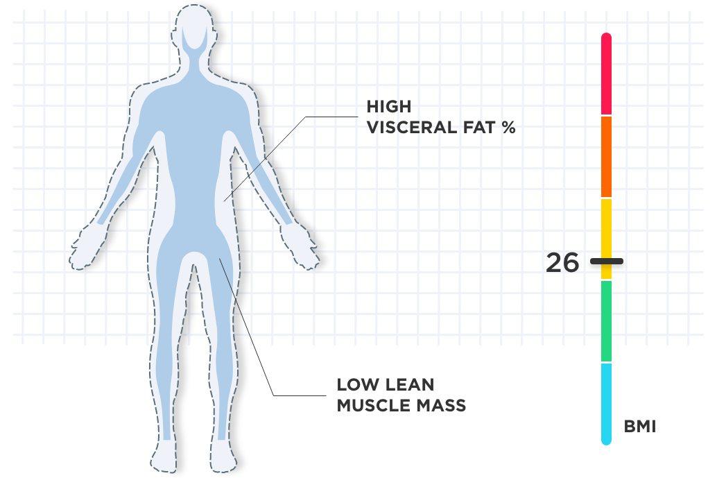 BMI: What is a healthy Body Mass Index - Health insights | Withings